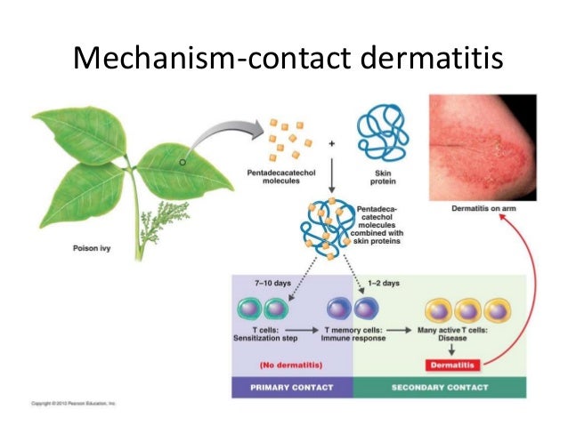 Role of cytokines in type iv hypersensitivity