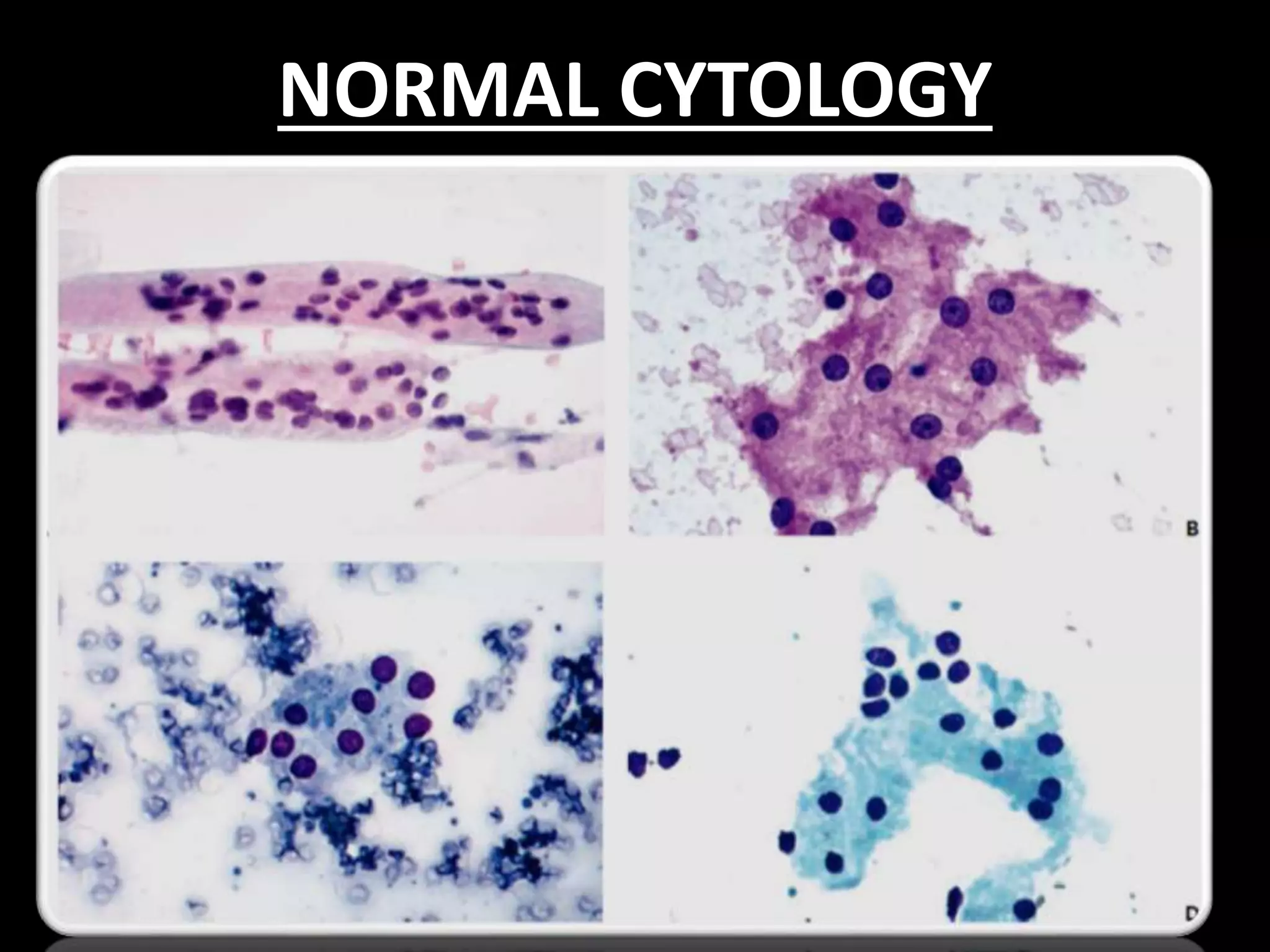 Role of cytology in renal lesions | PPTX