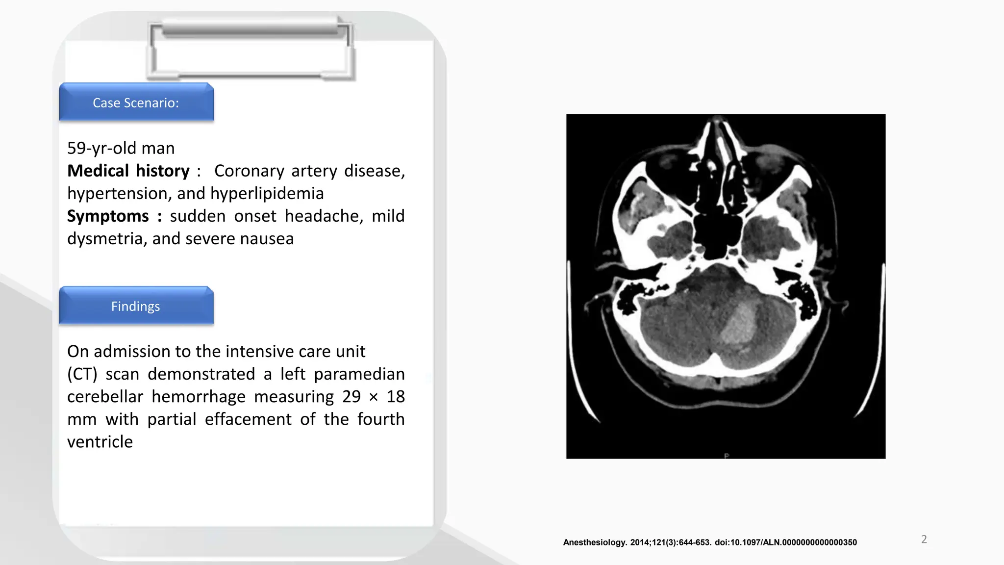 Role of DAPT In ACS patients.Cardiologypptx | PPTX