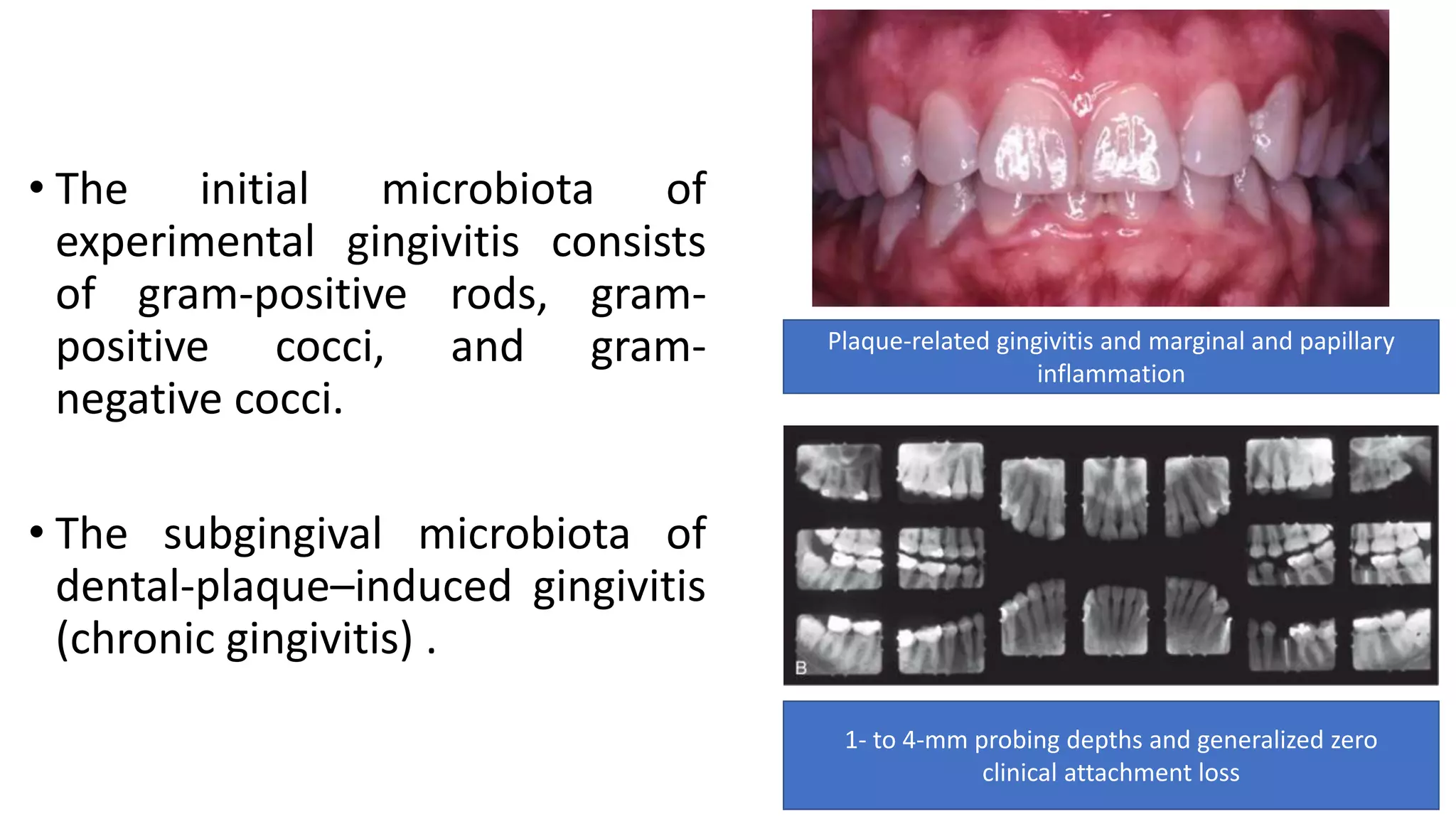 Role of dental biofilm in pathogenesis of periodontal | PPTX