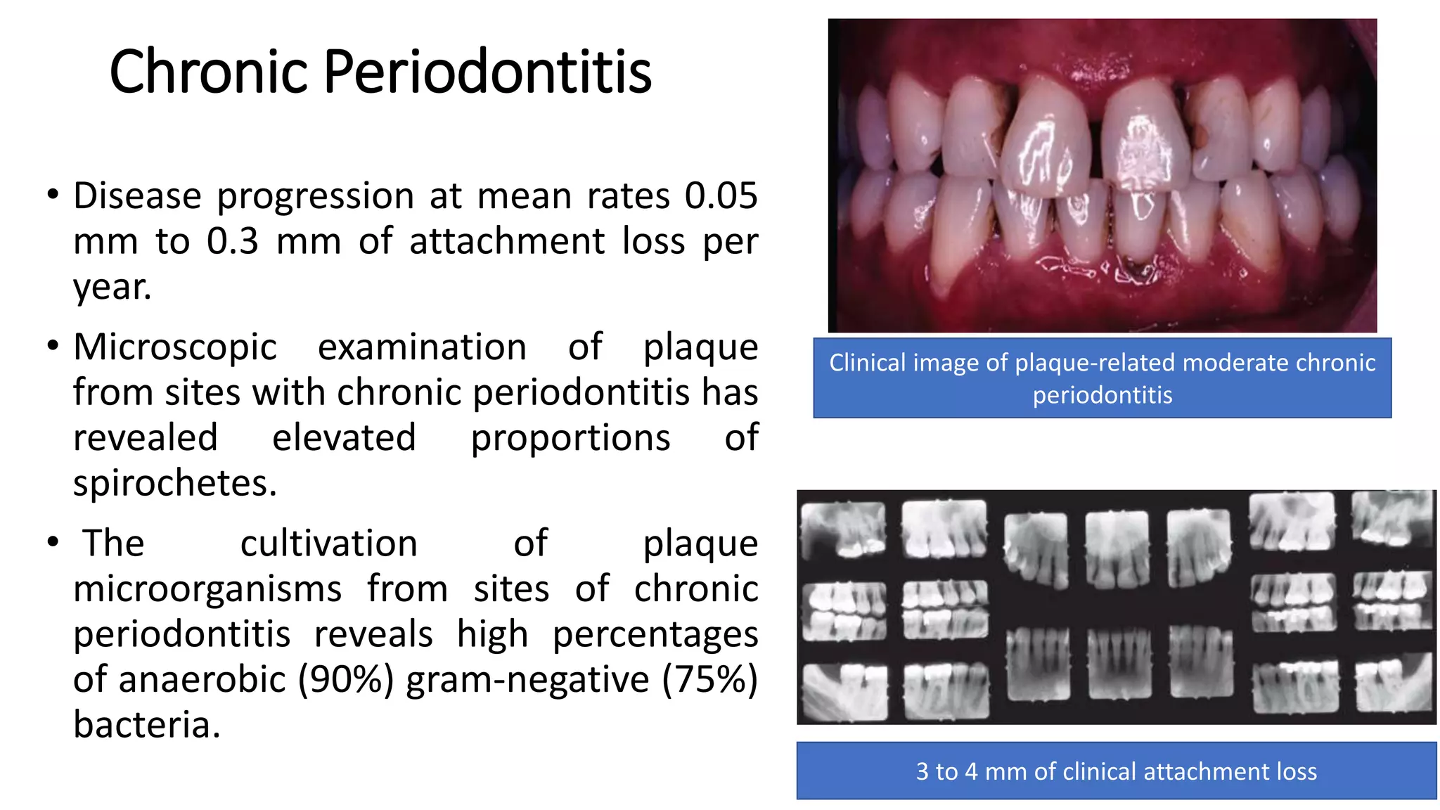 Role of dental biofilm in pathogenesis of periodontal | PPTX