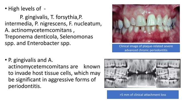 Role of dental biofilm in pathogenesis of periodontal | PPTX | Oral ...