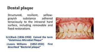 Role of dental biofilm in pathogenesis of periodontal | PPTX