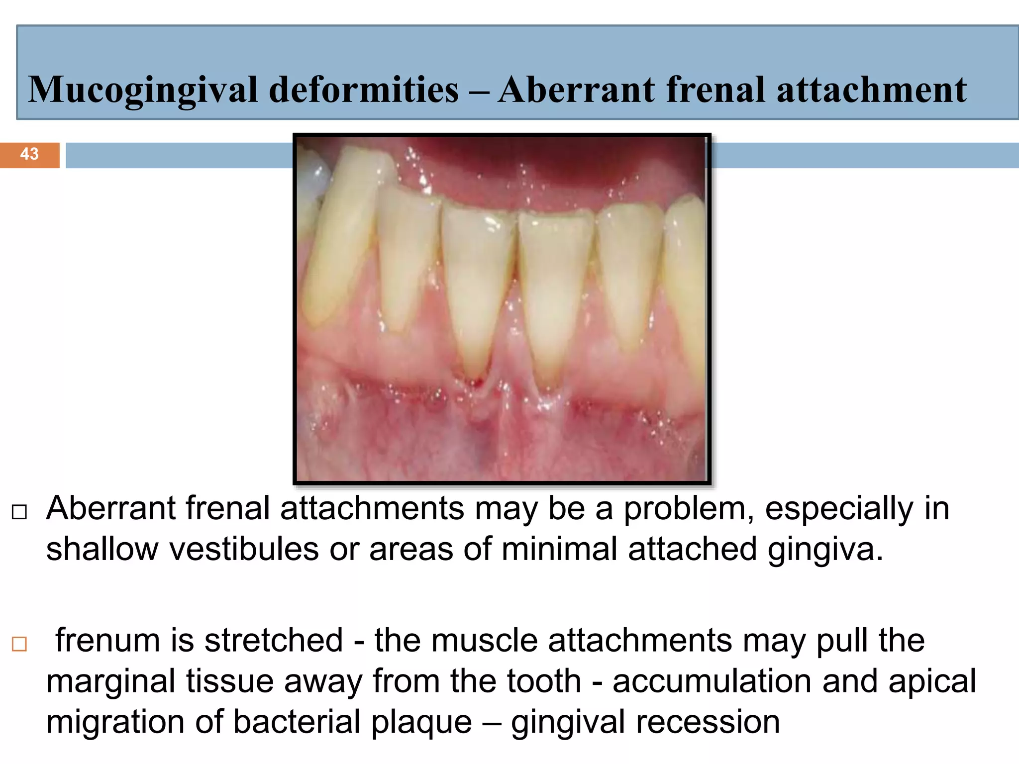 role of dental calculus DR SINDHURA.pptx