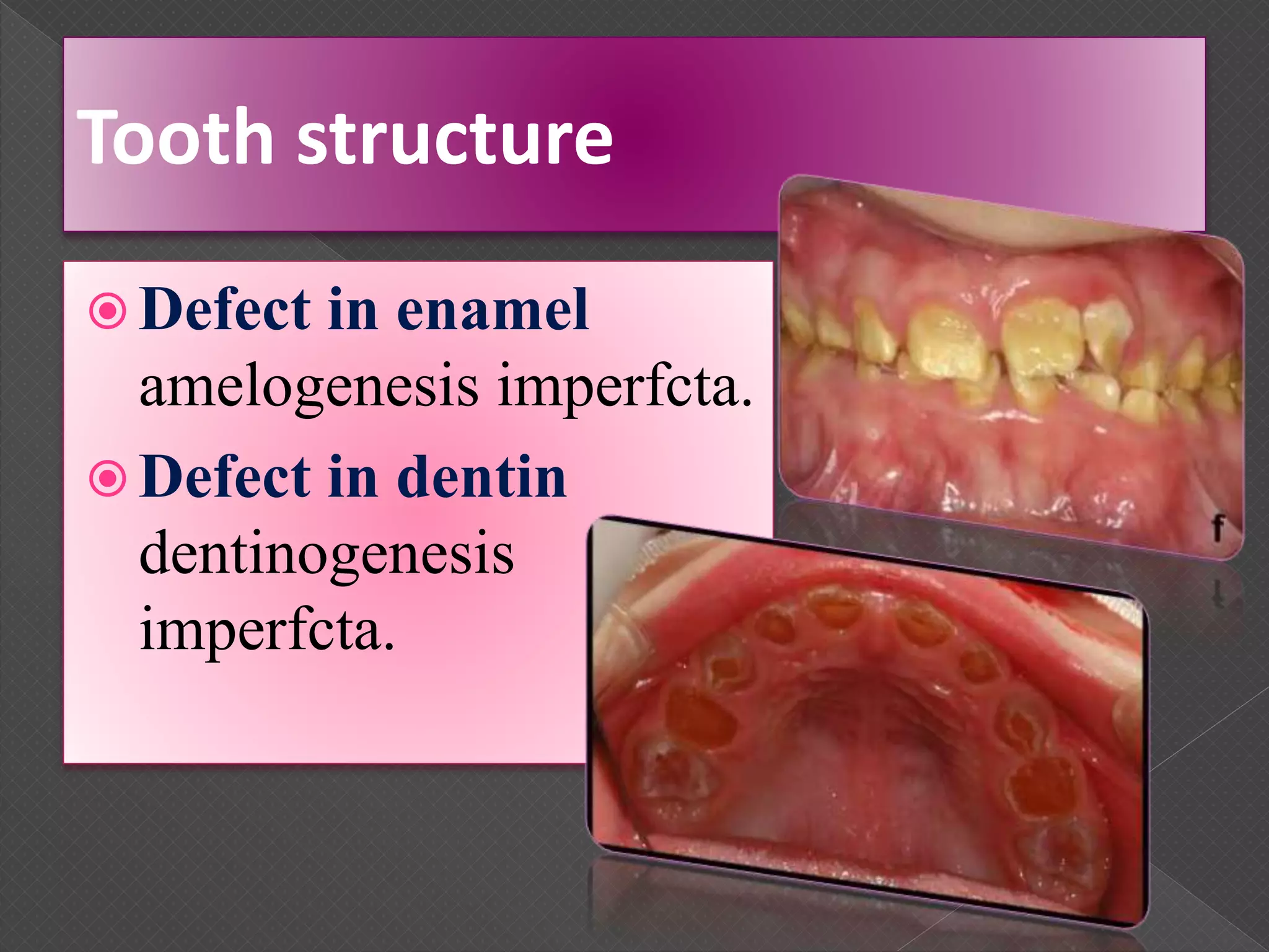 Role of diagnosis and treatment planning in pediatric dentistry | PPTX