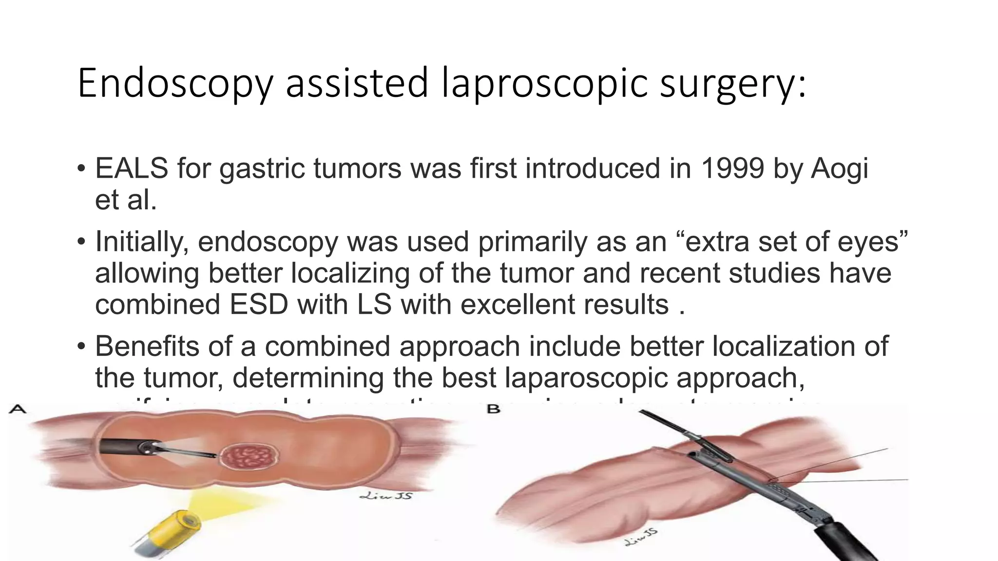 ROLE OF DIAGNOSTIC LAPROSCOPY IN ABDOMINAL MALIGNANCIES.pptx