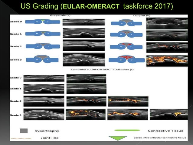 Role of Diagnostic Ultrasound in Rheumatology.ppt | Physical Therapy ...