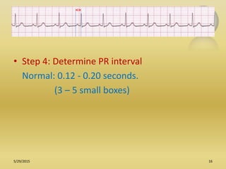 Role of ecg in pulmonology | PPTX