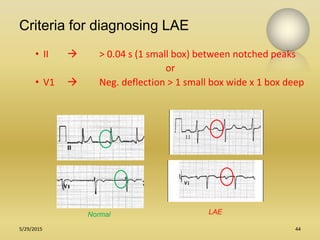 Role of ecg in pulmonology | PPTX
