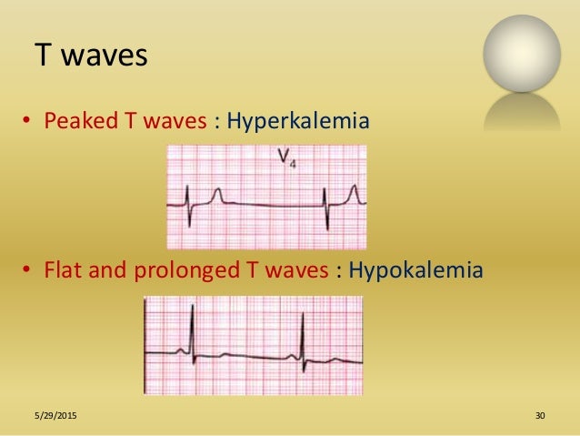 Role of ecg in pulmonology