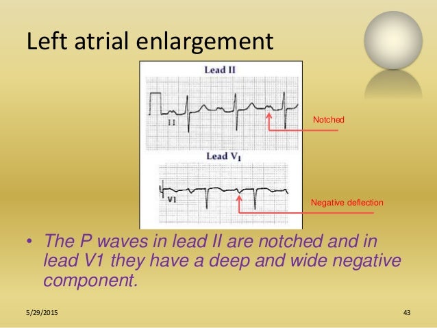 Role of ecg in pulmonology