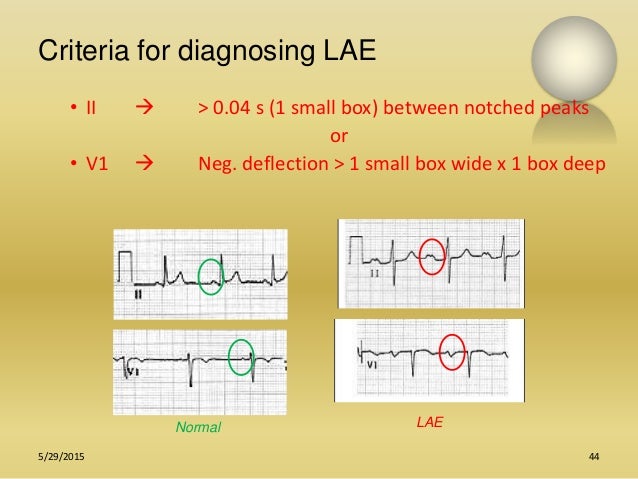Role of ecg in pulmonology