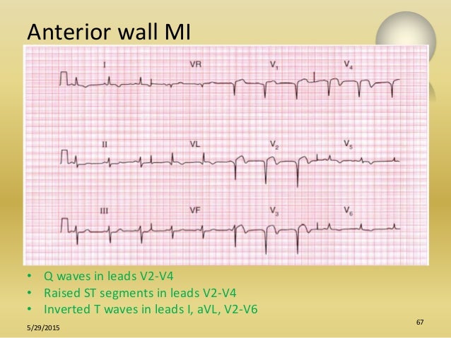 Role of ecg in pulmonology