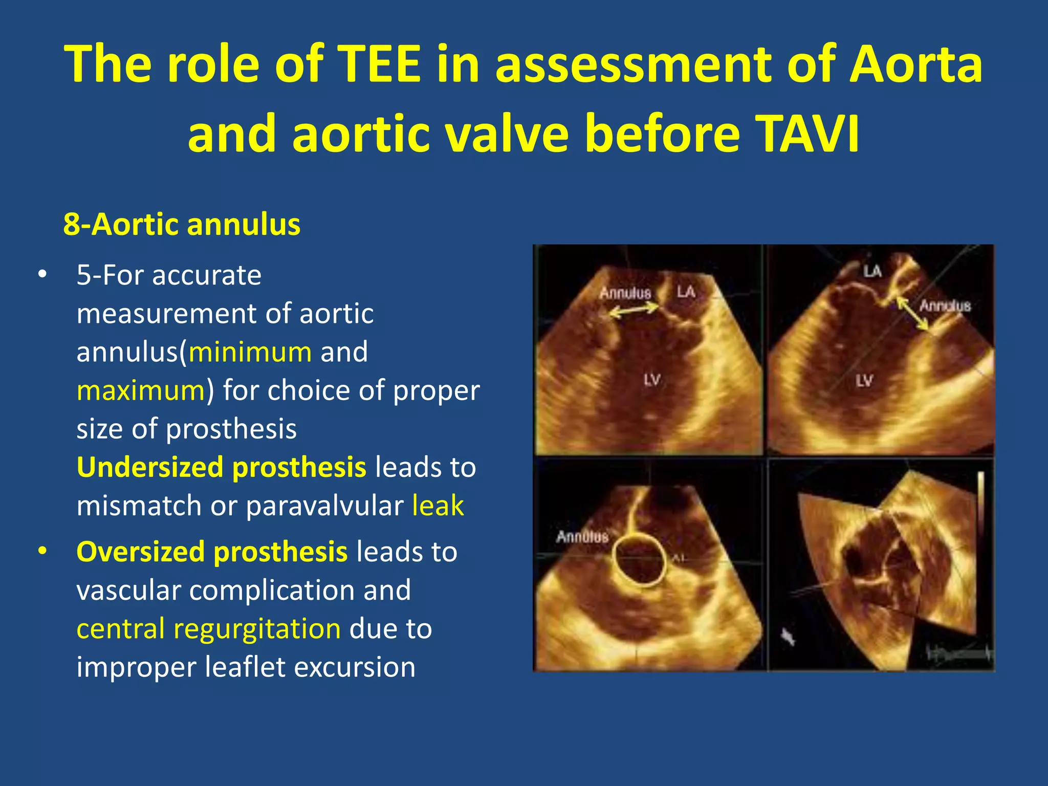 Role of echo in tavi | PDF