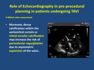 Role of echo in tavi | PDF