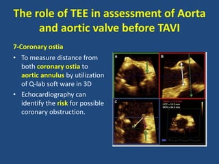 Role of echo in tavi | PPT