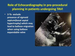 Role of echo in tavi | PDF