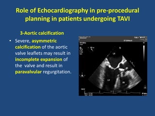 Role of echo in tavi | PDF
