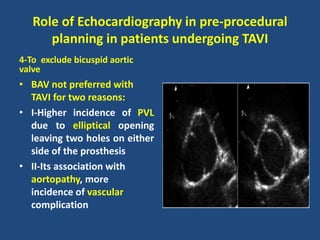 Role of echo in tavi | PDF