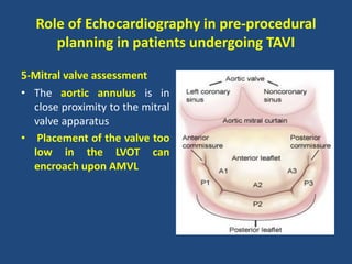 Role of echo in tavi | PDF