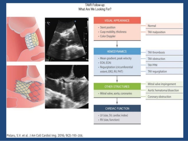 Role of echo in tavi