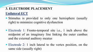 Role of ECT in psychiatry | PPTX