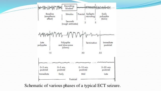 Role of ECT in psychiatry