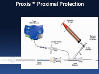 Role of embolic protection device in coronary and carotid intervention ...