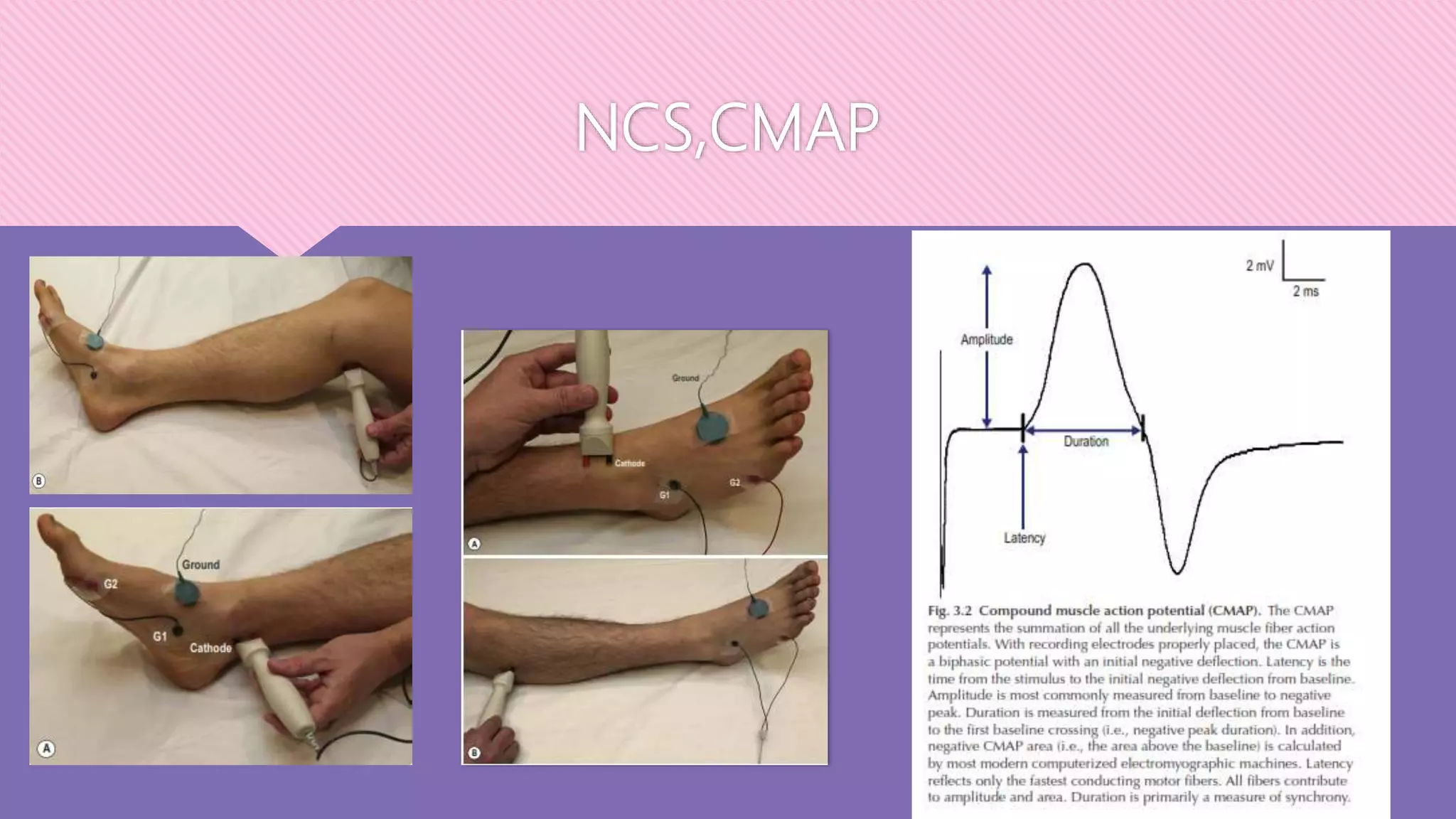 Role of EMG-NCS in piriformis syndrome.pptx
