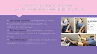 Role of EMG-NCS in piriformis syndrome.pptx