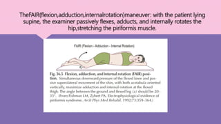 Role of EMG-NCS in piriformis syndrome.pptx