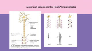 Role of EMG-NCS in piriformis syndrome.pptx