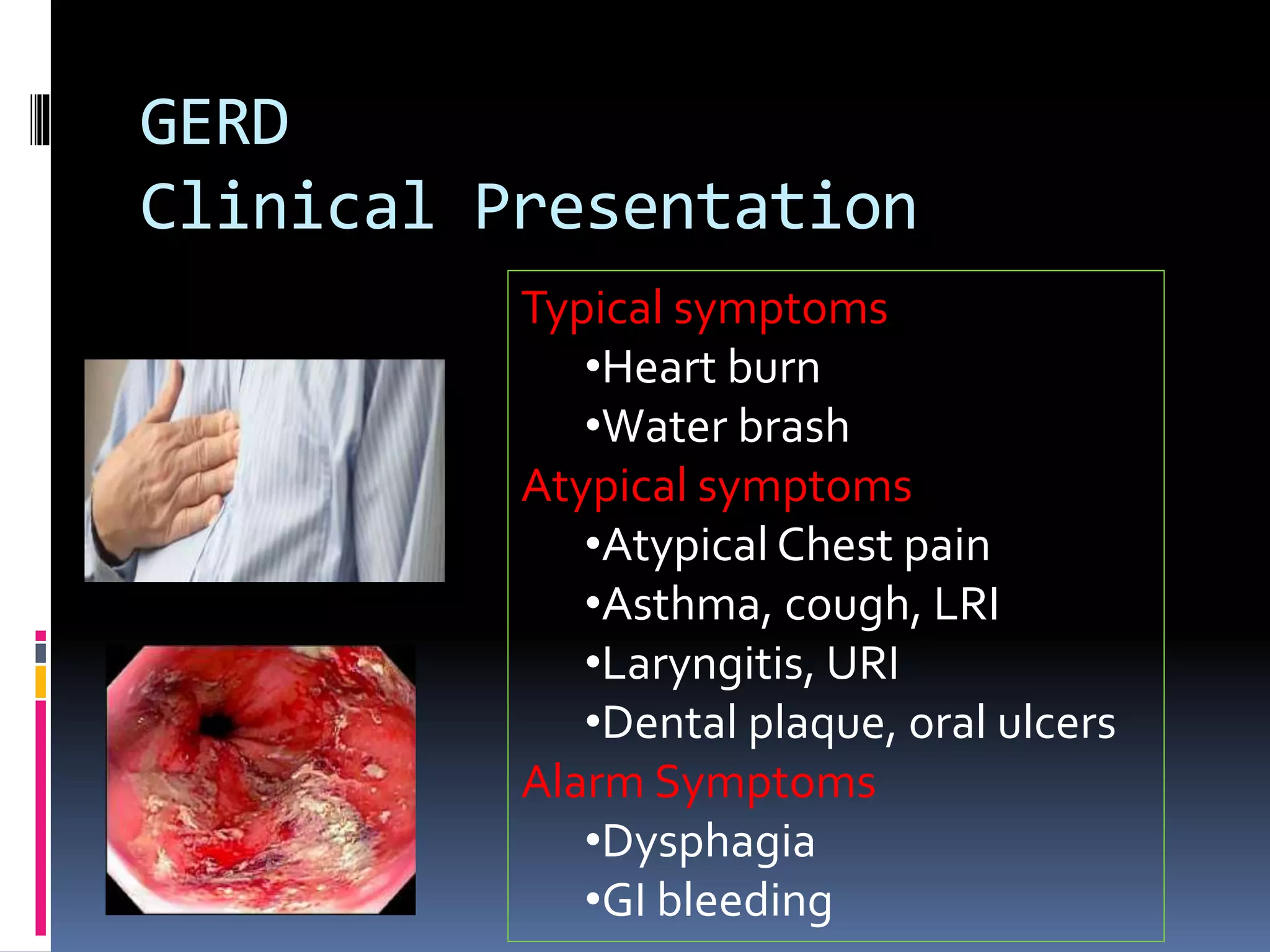 Role of endoscopy in achalasia and gerd | PPT