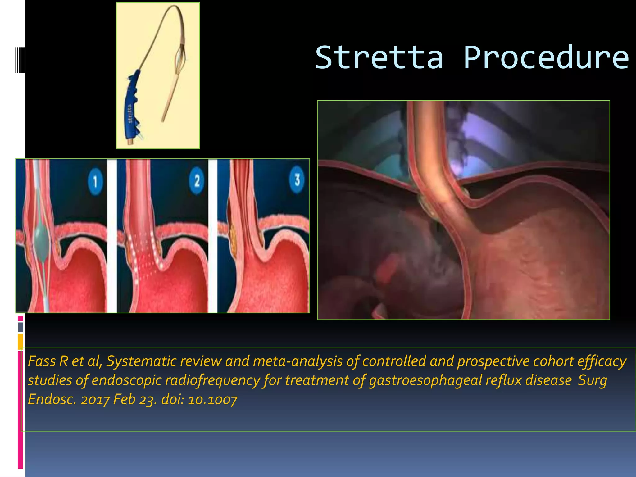 Role of endoscopy in achalasia and gerd | PPTX