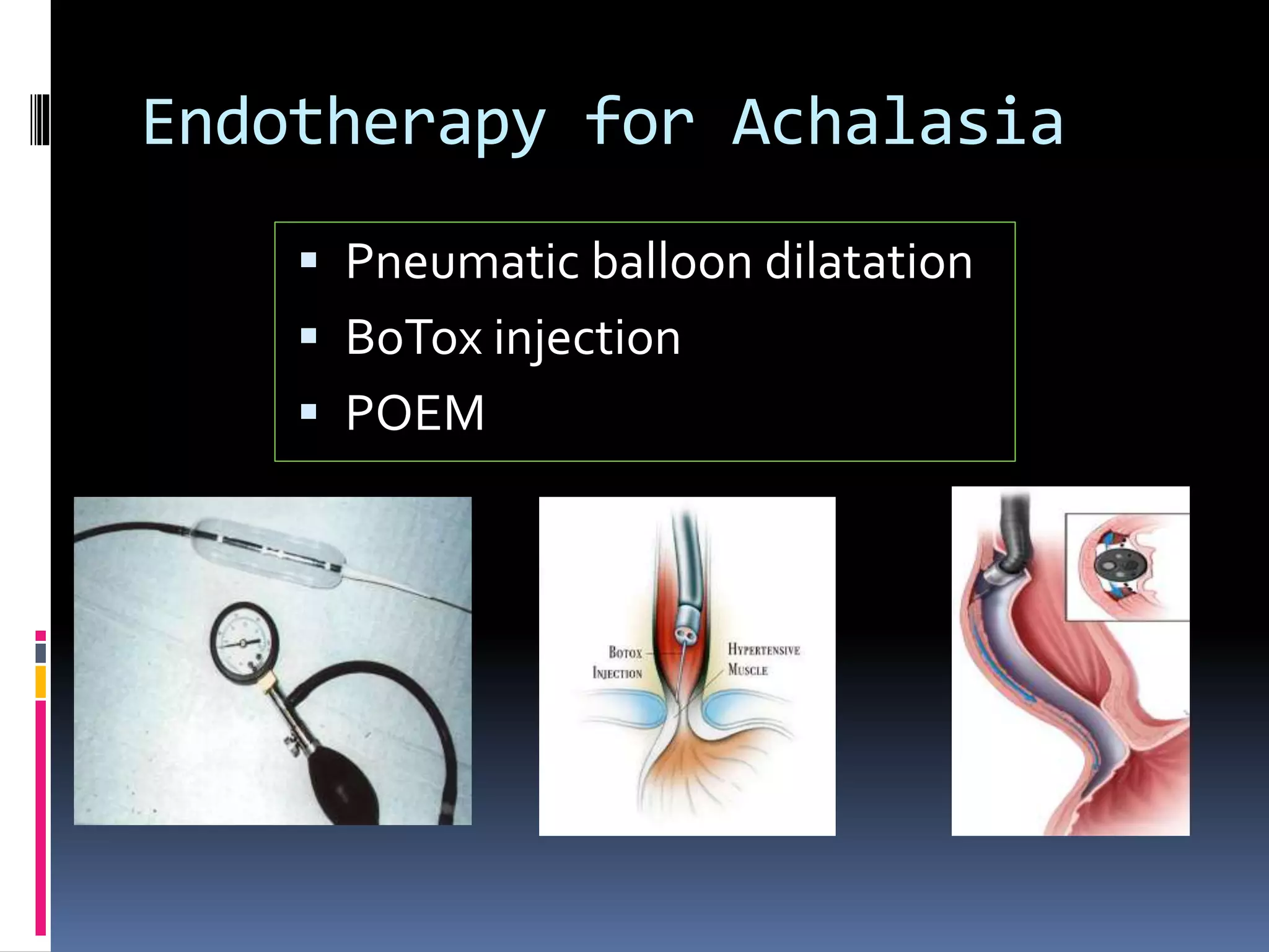 Role of endoscopy in achalasia and gerd | PPTX