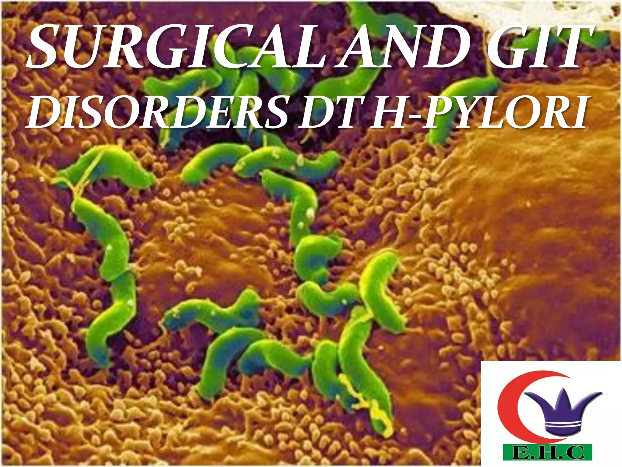 Role of endoscopy in management of h pylori disorders | PPT | Free Download