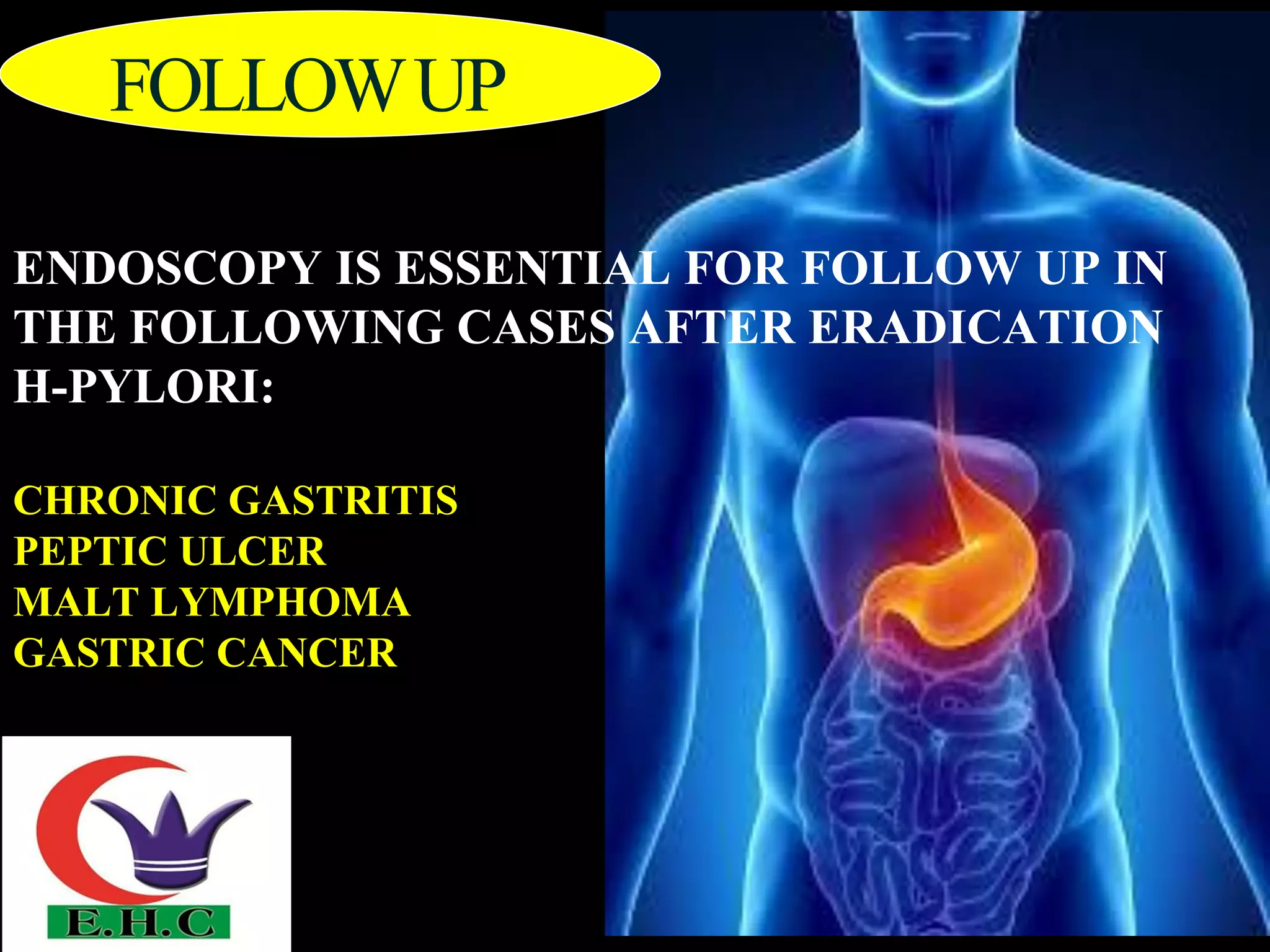 Role of endoscopy in management of h pylori disorders | PPT