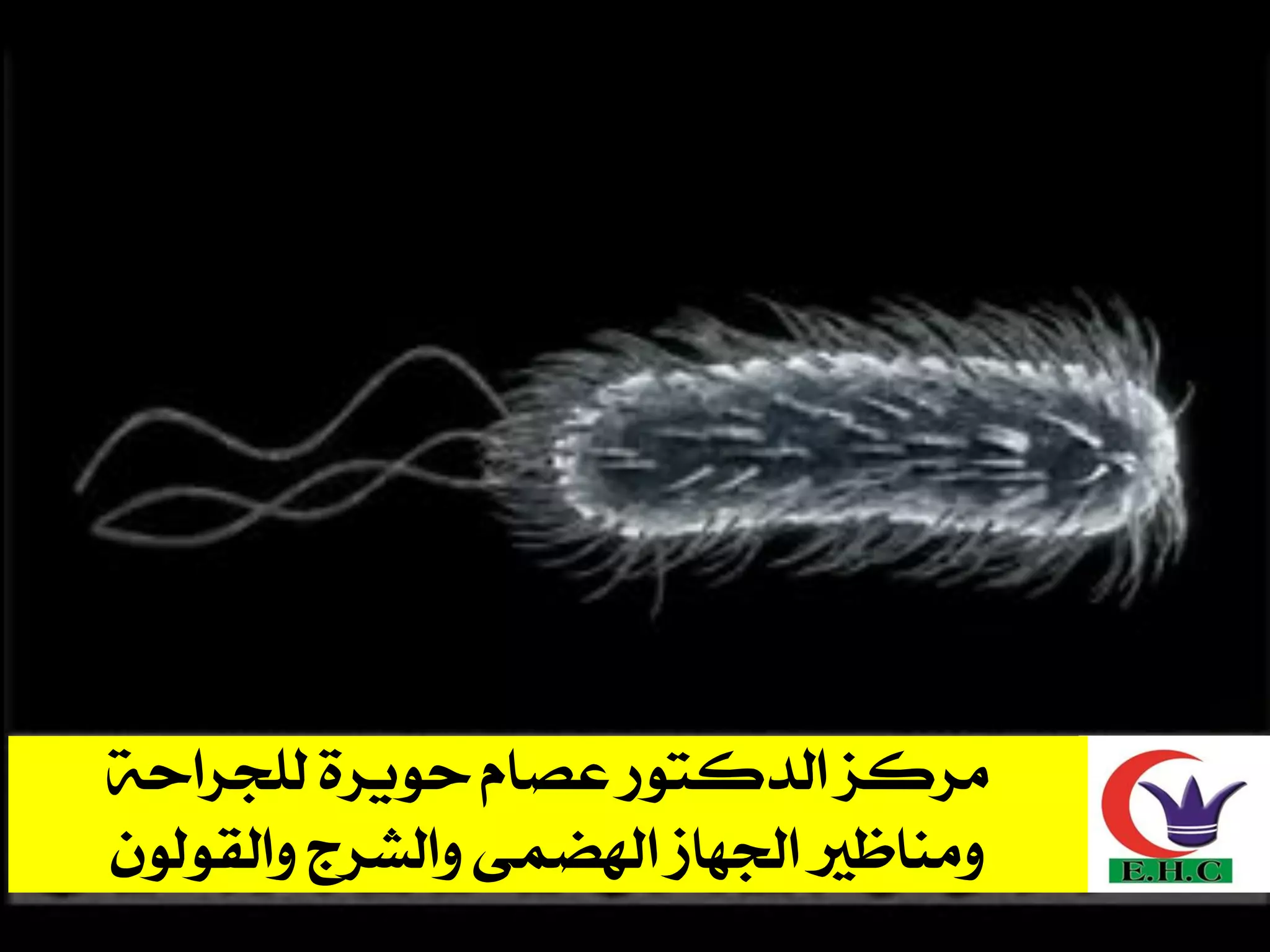 Role of endoscopy in management of h pylori disorders | PPT