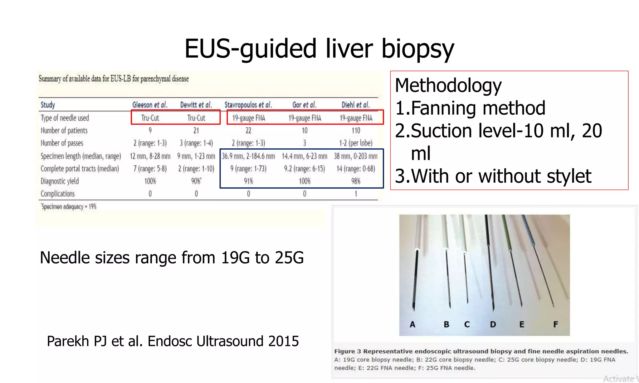Role of EUS in hepatobiliary diseases | PPTX