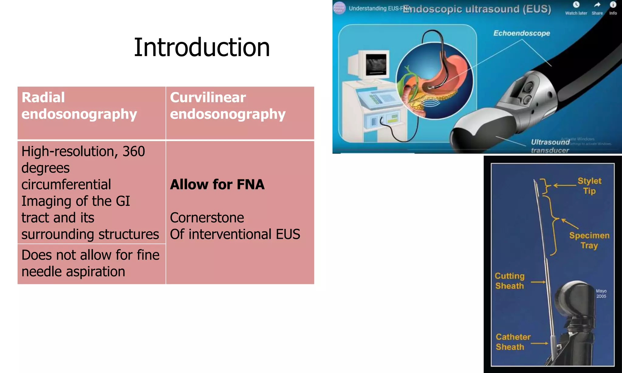 Role of EUS in hepatobiliary diseases | PPTX
