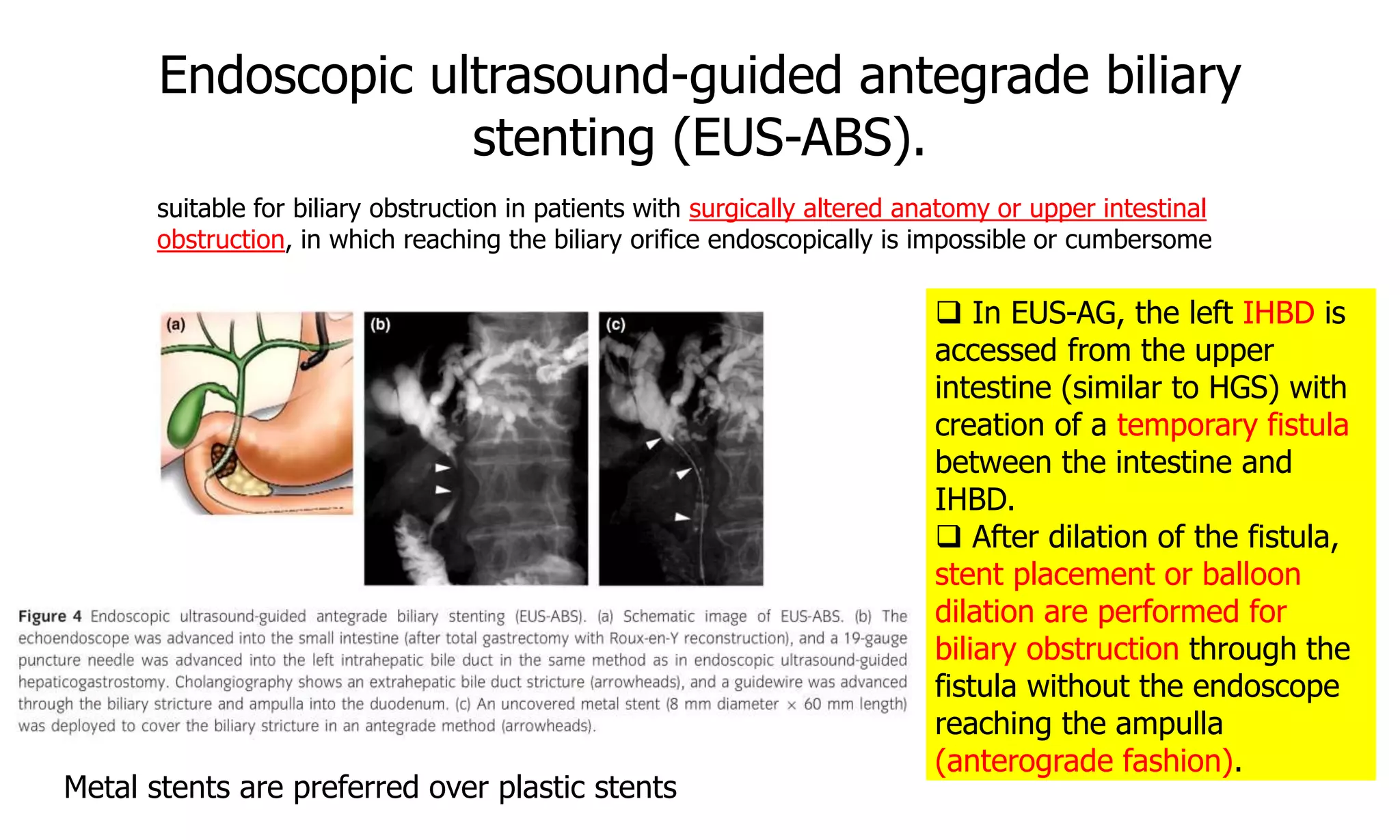 Role of EUS in hepatobiliary diseases | PPTX
