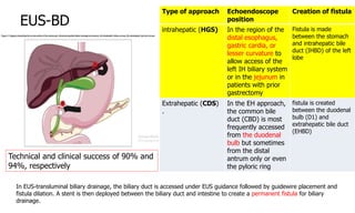 Role of EUS in hepatobiliary diseases | PPTX