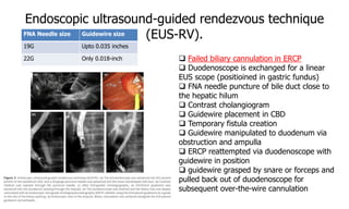 Role of EUS in hepatobiliary diseases | PPTX