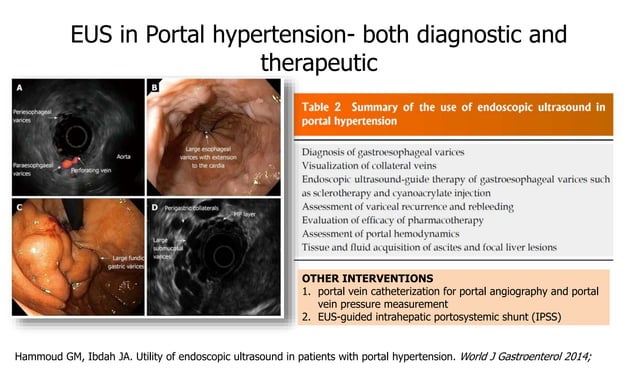 Role of EUS in hepatobiliary diseases | PPTX