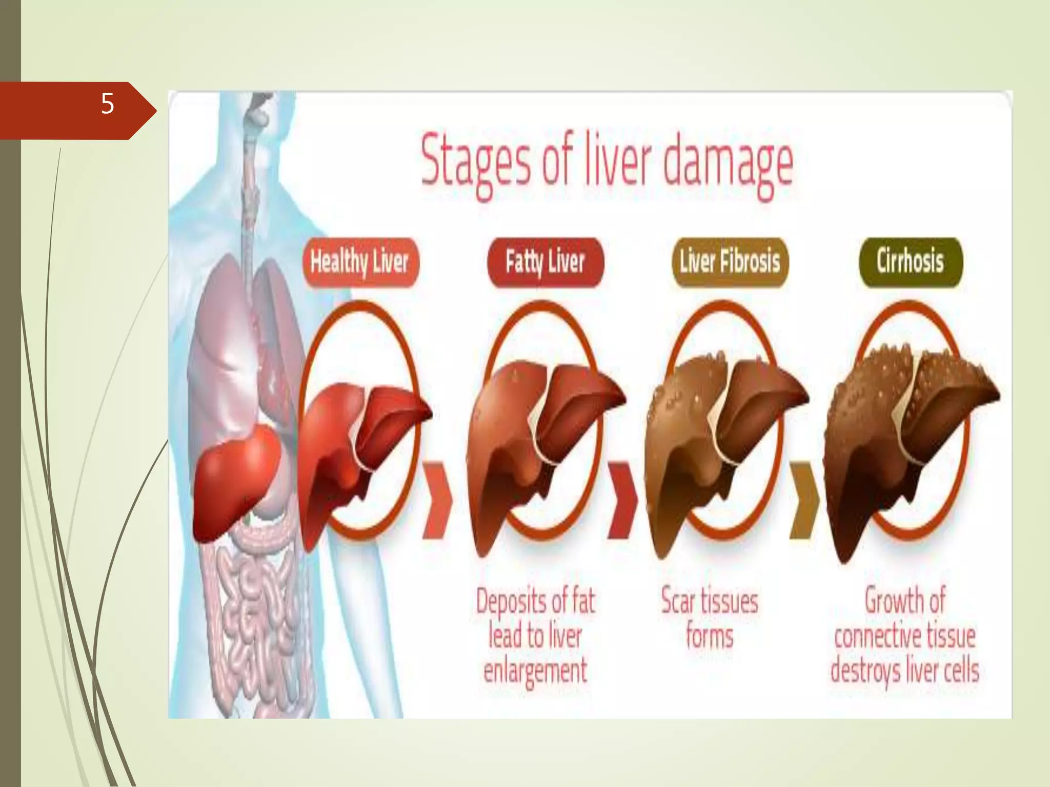 Role of exercise in non alcoholic fatty liver disease | PPTX