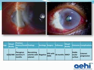 Role of Eye Bank beyond Cornea - Sclera | PPT