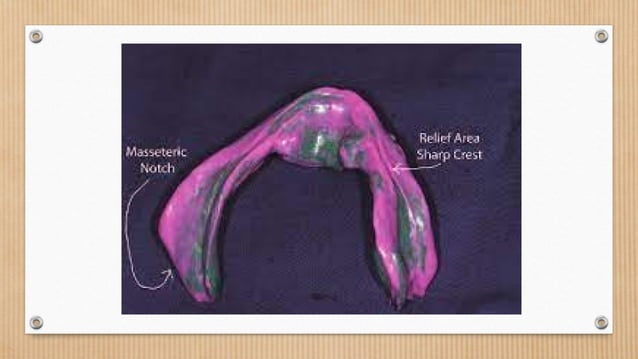 ROLE OF FACIAL MUSCLES IN COMPLETE DENTURE.pptx