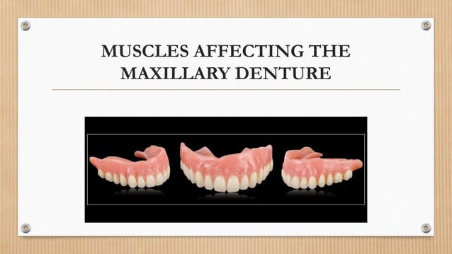 ROLE OF FACIAL MUSCLES IN COMPLETE DENTURE.pptx