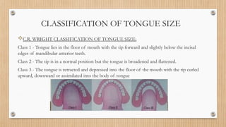 ROLE OF FACIAL MUSCLES IN COMPLETE DENTURE.pptx