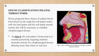 ROLE OF FACIAL MUSCLES IN COMPLETE DENTURE.pptx